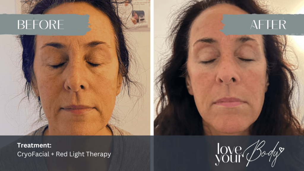 Clearwater Premier Body Sculpting | Body Transformation & Wellness